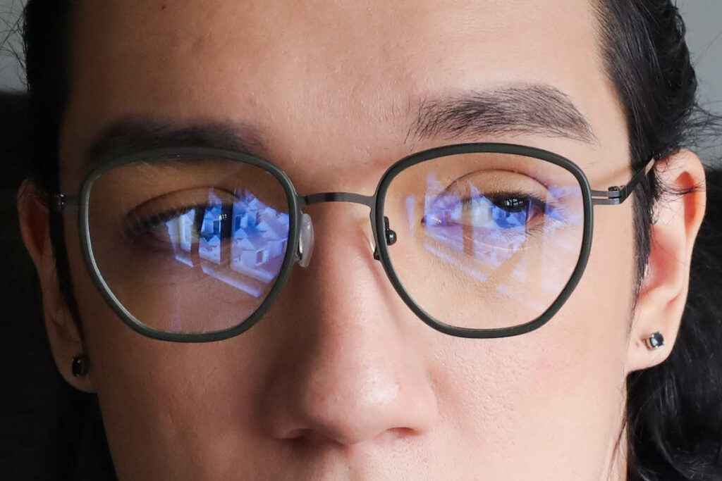 What Is Computer Vision Syndrome & How to Prevent It